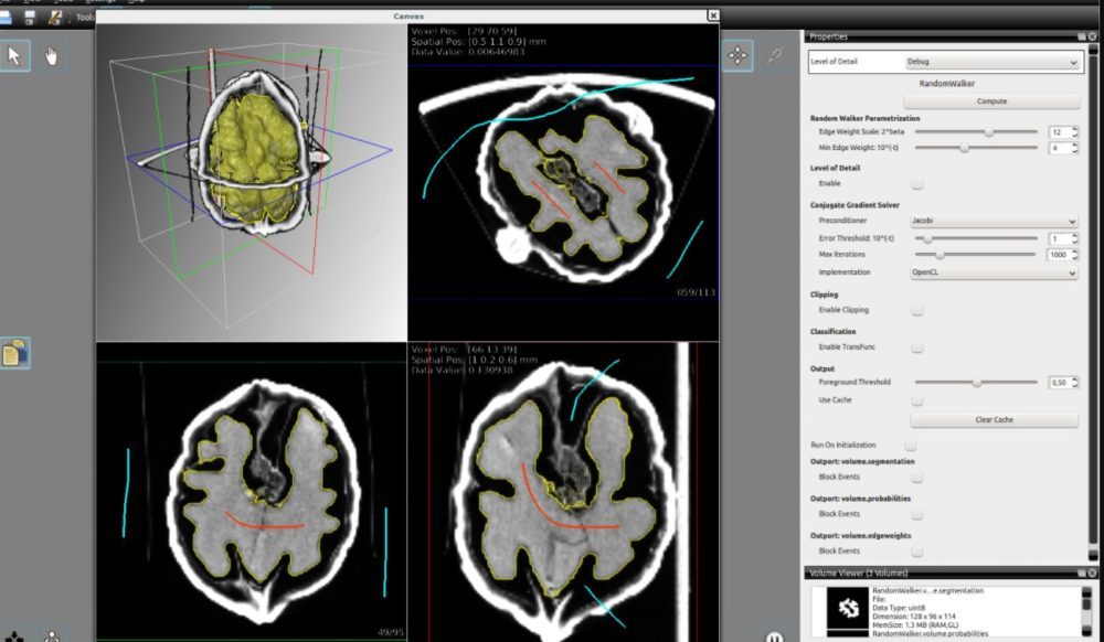 Voreen in 2024 - Reviews, Features, Pricing, Comparison - PAT RESEARCH: B2B Reviews, Buying ...